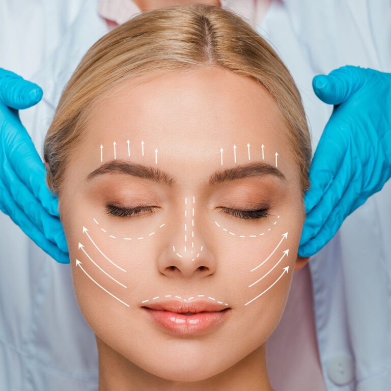 APTOS threads - Procedure, Effects • OT.CO Poland