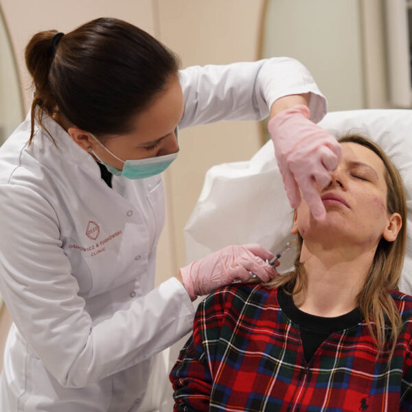 Face volumetry - Cost, Before and After • OT.CO Poland