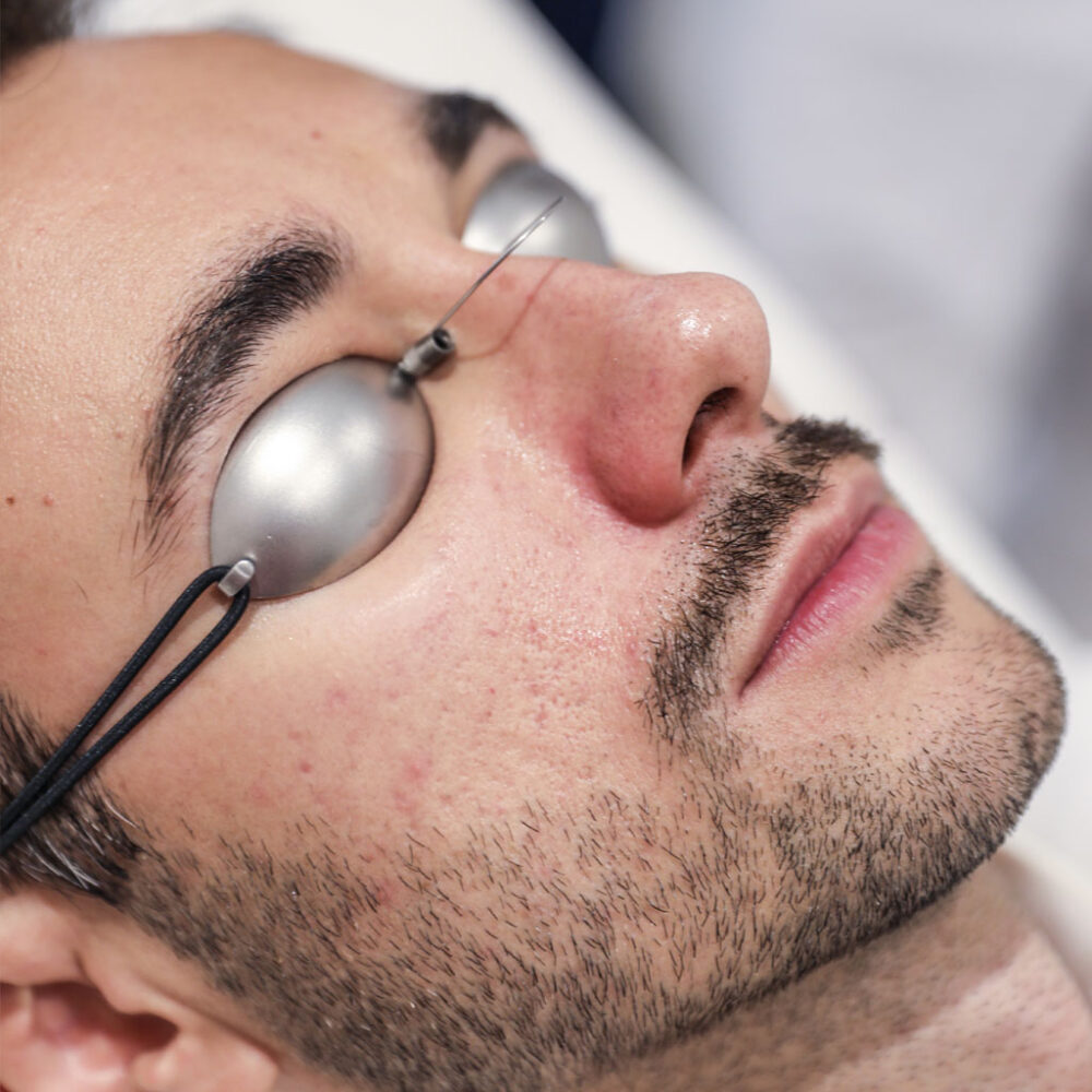 Laser removal of skin lesions - Procedure • OT.CO Poland