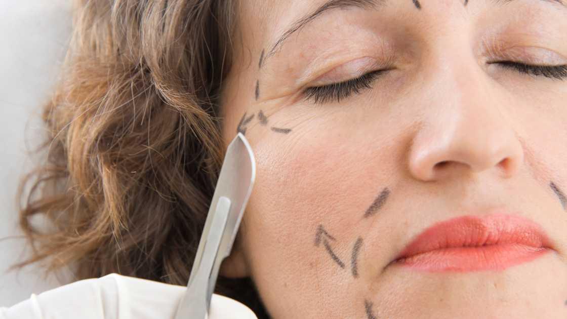 Mini facelift or worth it? Learn the facts. • OT.CO Clinic