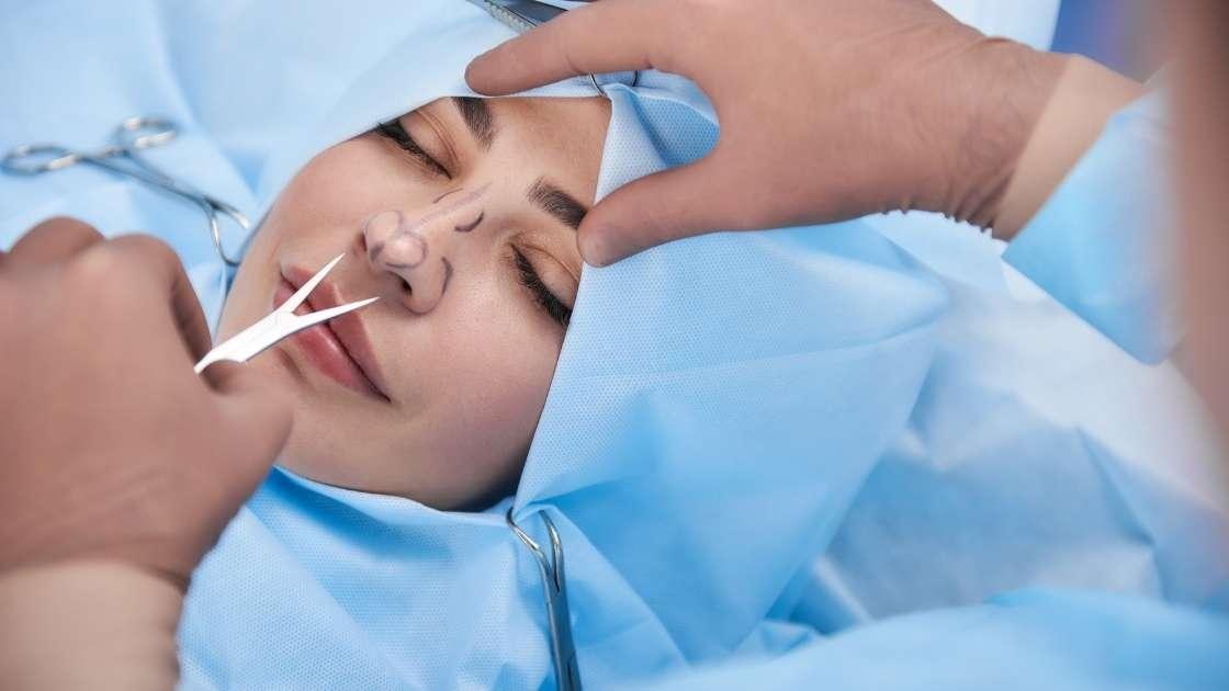 Rhinoplasty - what does the procedure consist of? • OT.CO Clinic