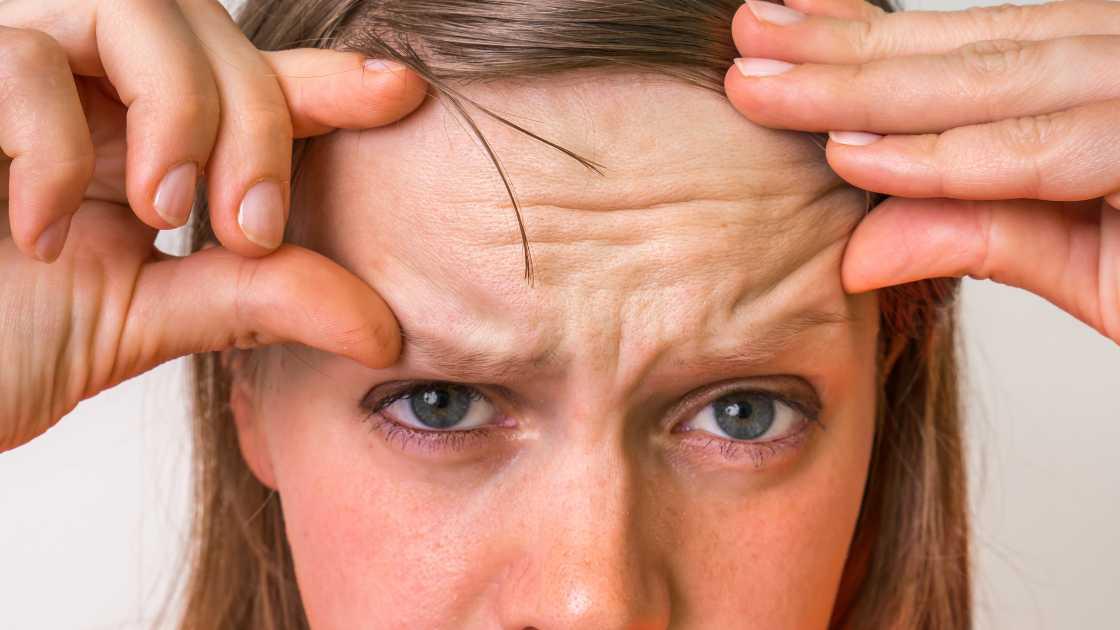 Mesotherapy for forehead wrinkles: does it work? • OT.CO Clinic