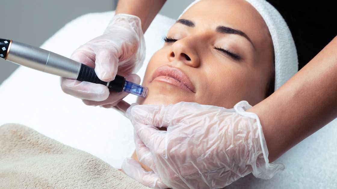 Dermapen effects: What can be obtained after the treatment? • OT.CO Clinic