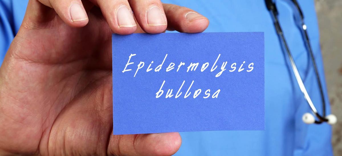 Epidermolysis Bullosa - symptoms, treatment and life of patients with ...
