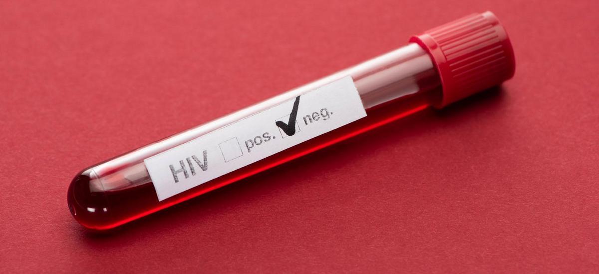 HIV - what is worth knowing? Comprehensive guide 2025 • OT.CO Clinic