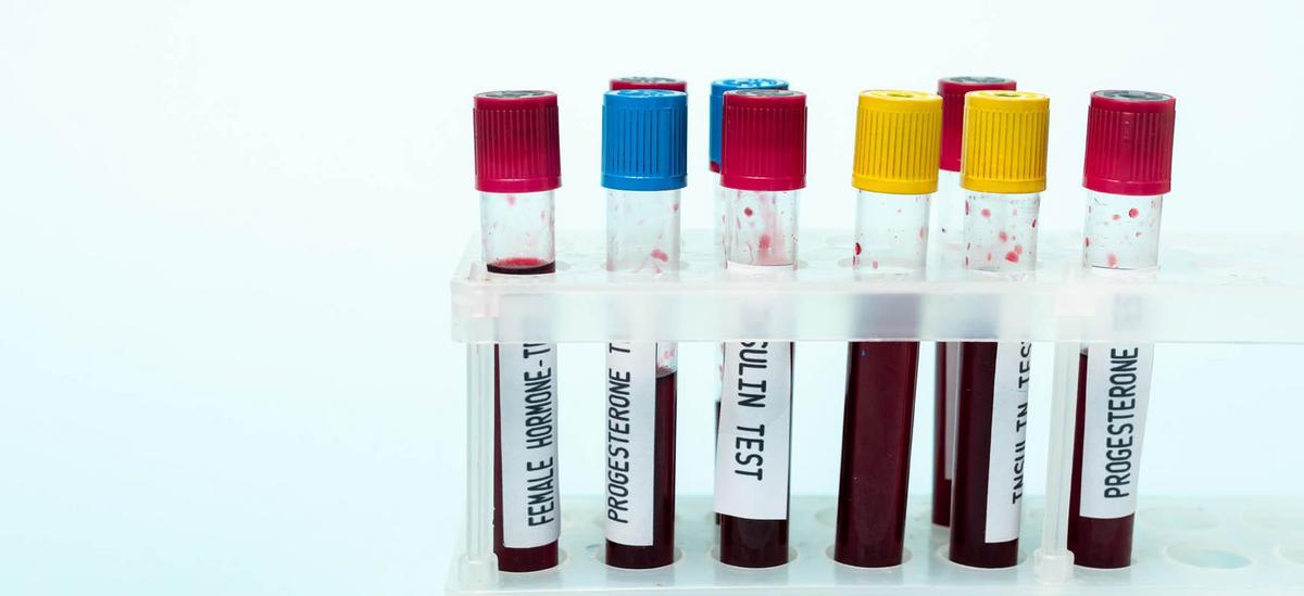 Hormone tests - how to read the results? When to perform? • OT.CO Clinic