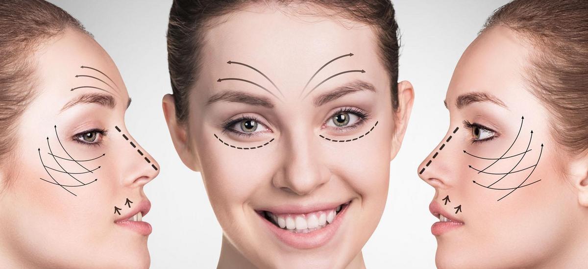 What is a 7 and 9 point hyaluronic acid lift? • OT.CO Clinic